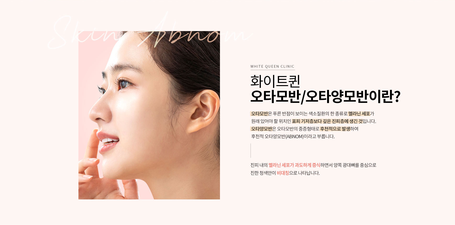 오타모반/오타양모반 | 대구 헤이븐의원